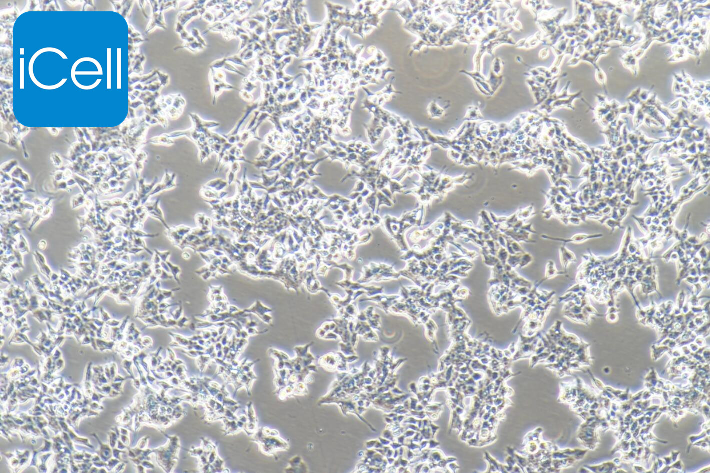 22Rv1 人前列腺癌细胞-原代细胞-STR细胞-细胞培养基-镜像绮点生物