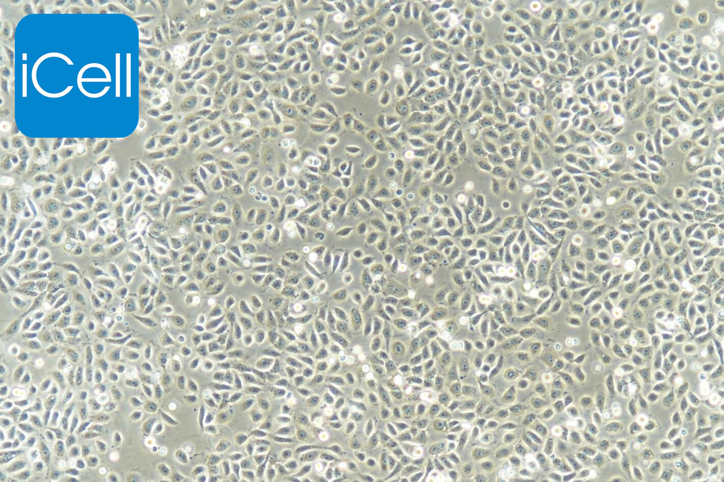 5637 人膀胱癌细胞-原代细胞-STR细胞-细胞培养基-镜像绮点生物