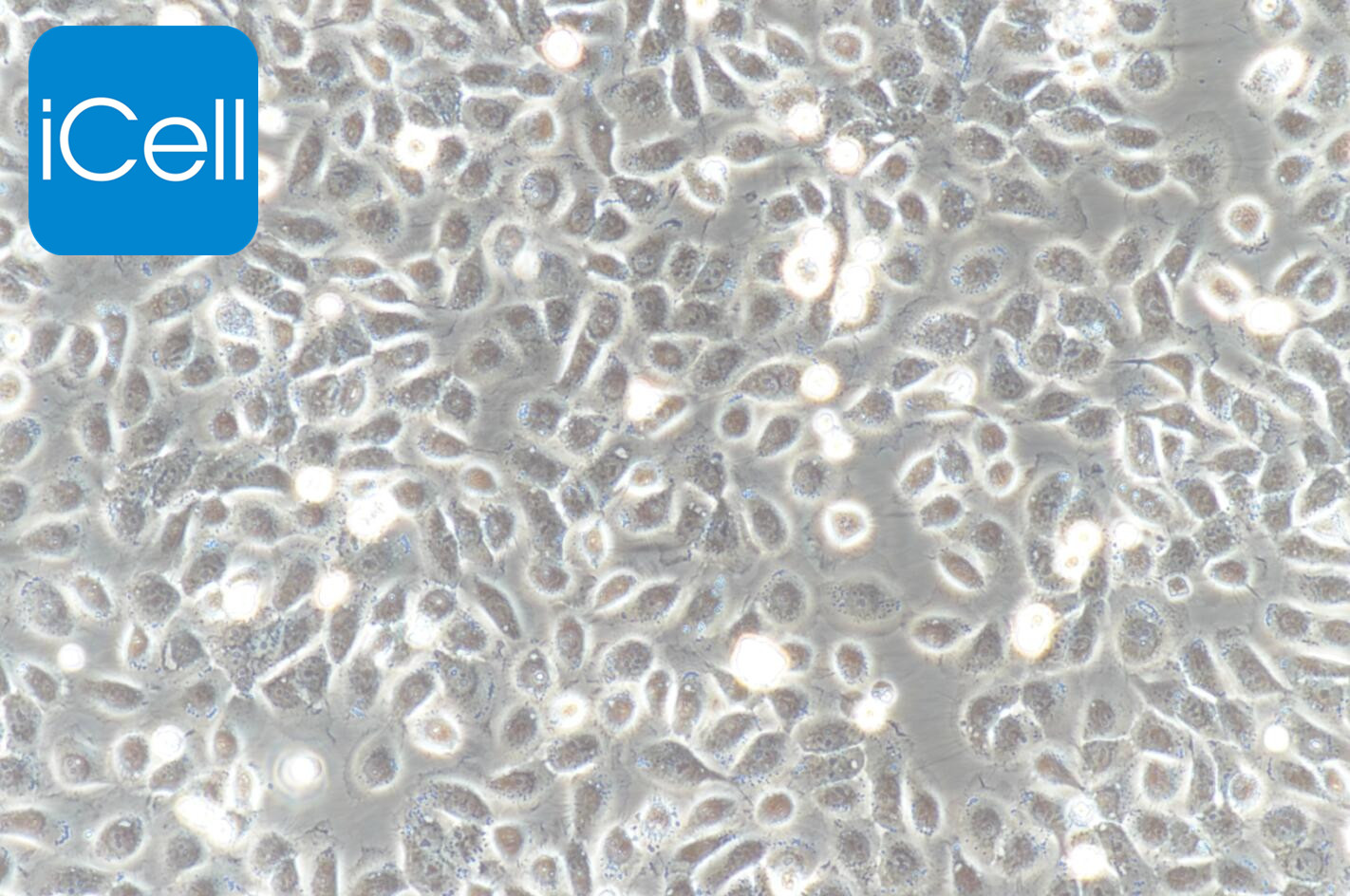 5637 人膀胱癌细胞-原代细胞-STR细胞-细胞培养基-镜像绮点生物