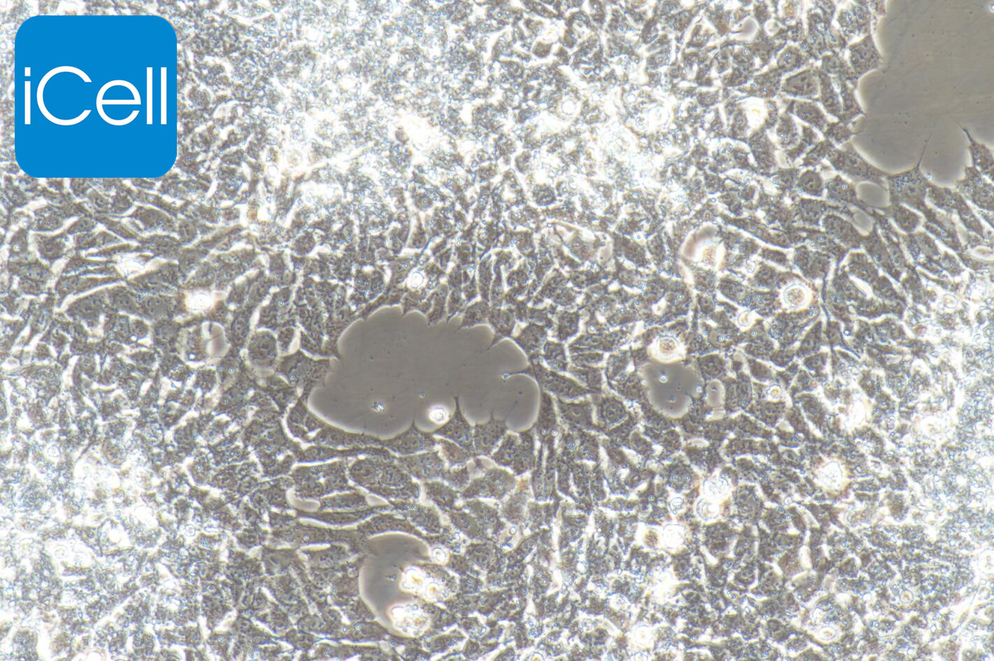 SK-N-MC 人神经上皮瘤细胞-原代细胞-STR细胞-细胞培养基-镜像绮点生物