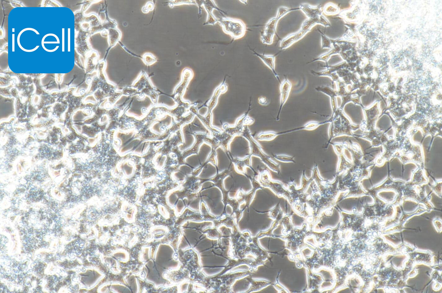 SH-SY5Y 人神经母细胞瘤细胞-原代细胞-STR细胞-细胞培养基-镜像绮点生物