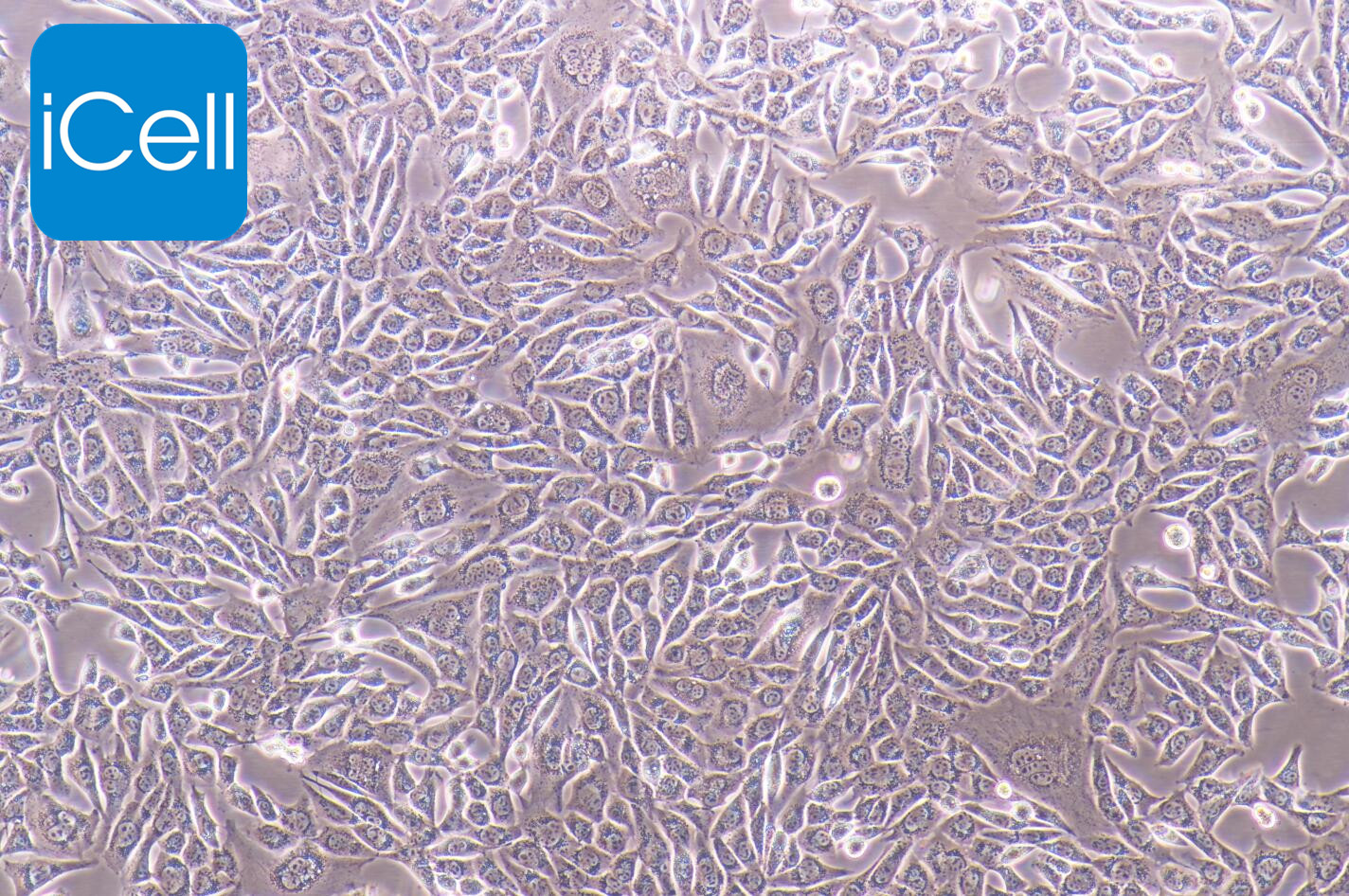 ID8 小鼠卵巢上皮癌细胞-原代细胞-STR细胞-细胞培养基-镜像绮点生物