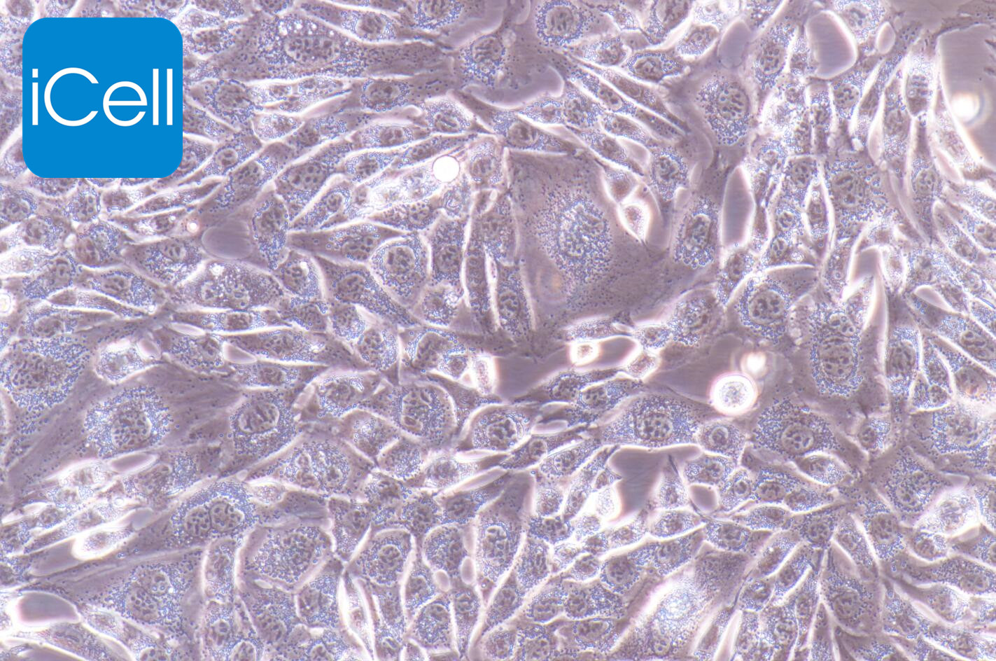 ID8 小鼠卵巢上皮癌细胞-原代细胞-STR细胞-细胞培养基-镜像绮点生物