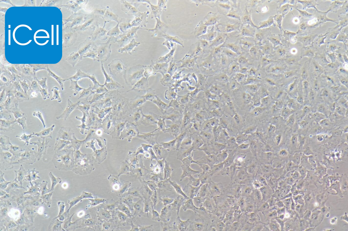 HS578T 人乳腺癌细胞-原代细胞-STR细胞-细胞培养基-镜像绮点生物