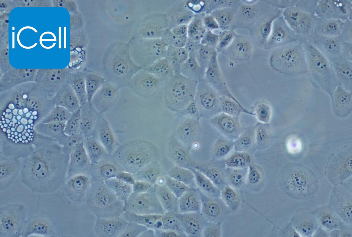 HCC1937 人乳腺癌细胞-原代细胞-STR细胞-细胞培养基-镜像绮点生物