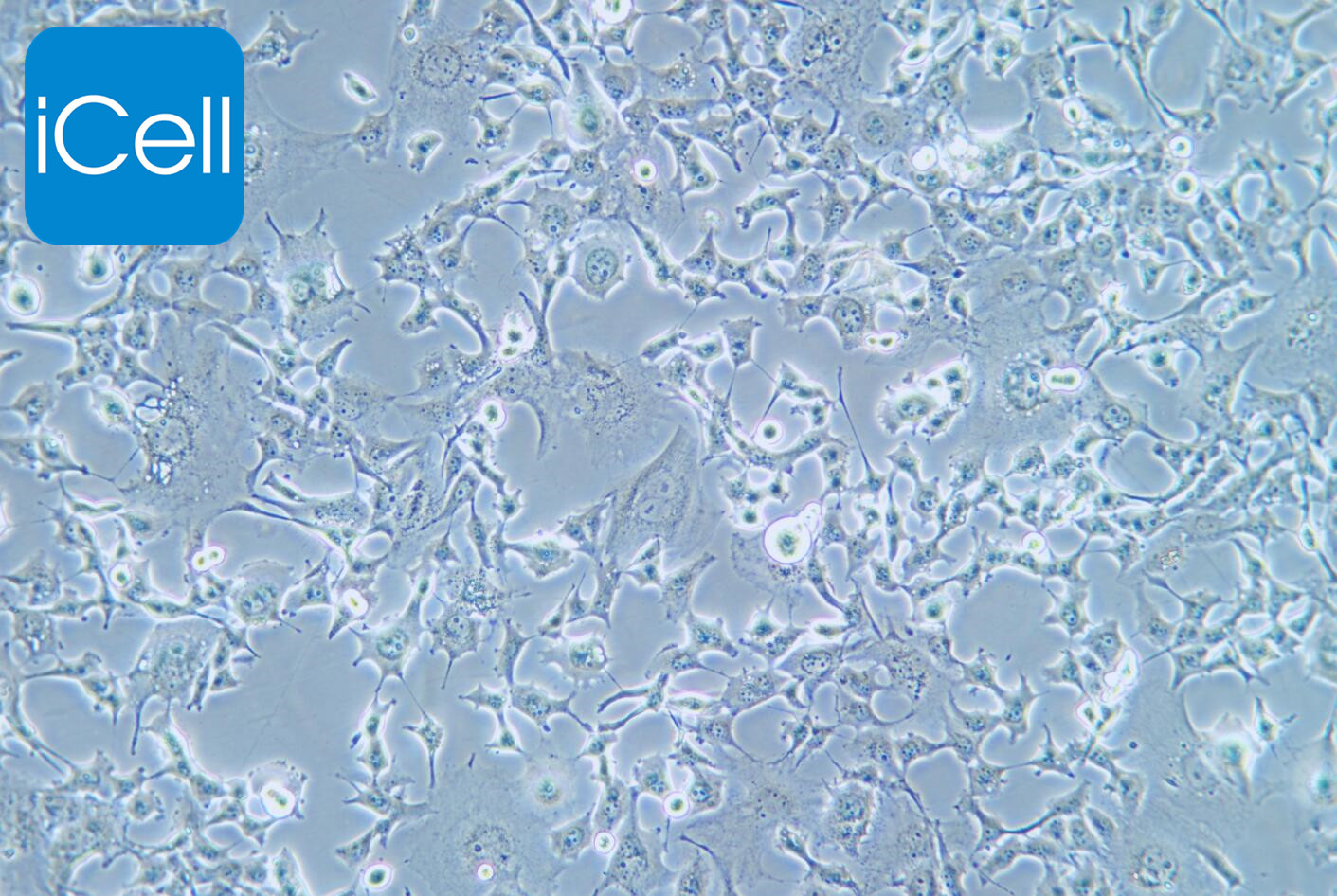 Hs746T 人胃癌细胞-原代细胞-STR细胞-细胞培养基-镜像绮点生物