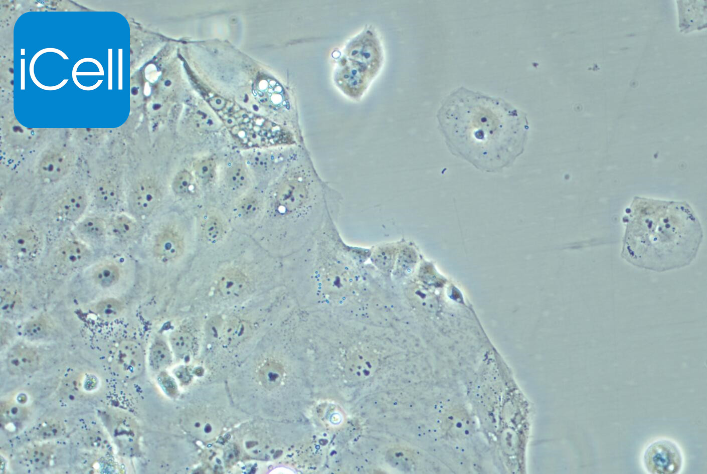 HuH-6 人肝母细胞瘤细胞-原代细胞-STR细胞-细胞培养基-镜像绮点生物