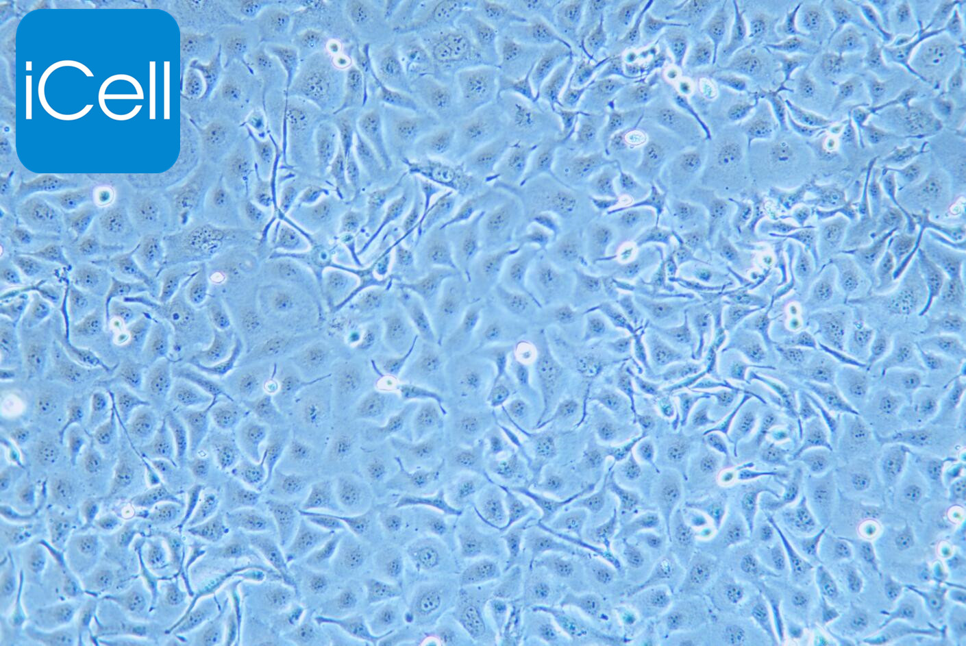 KYSE410 人食道鳞状癌细胞-原代细胞-STR细胞-细胞培养基-镜像绮点生物