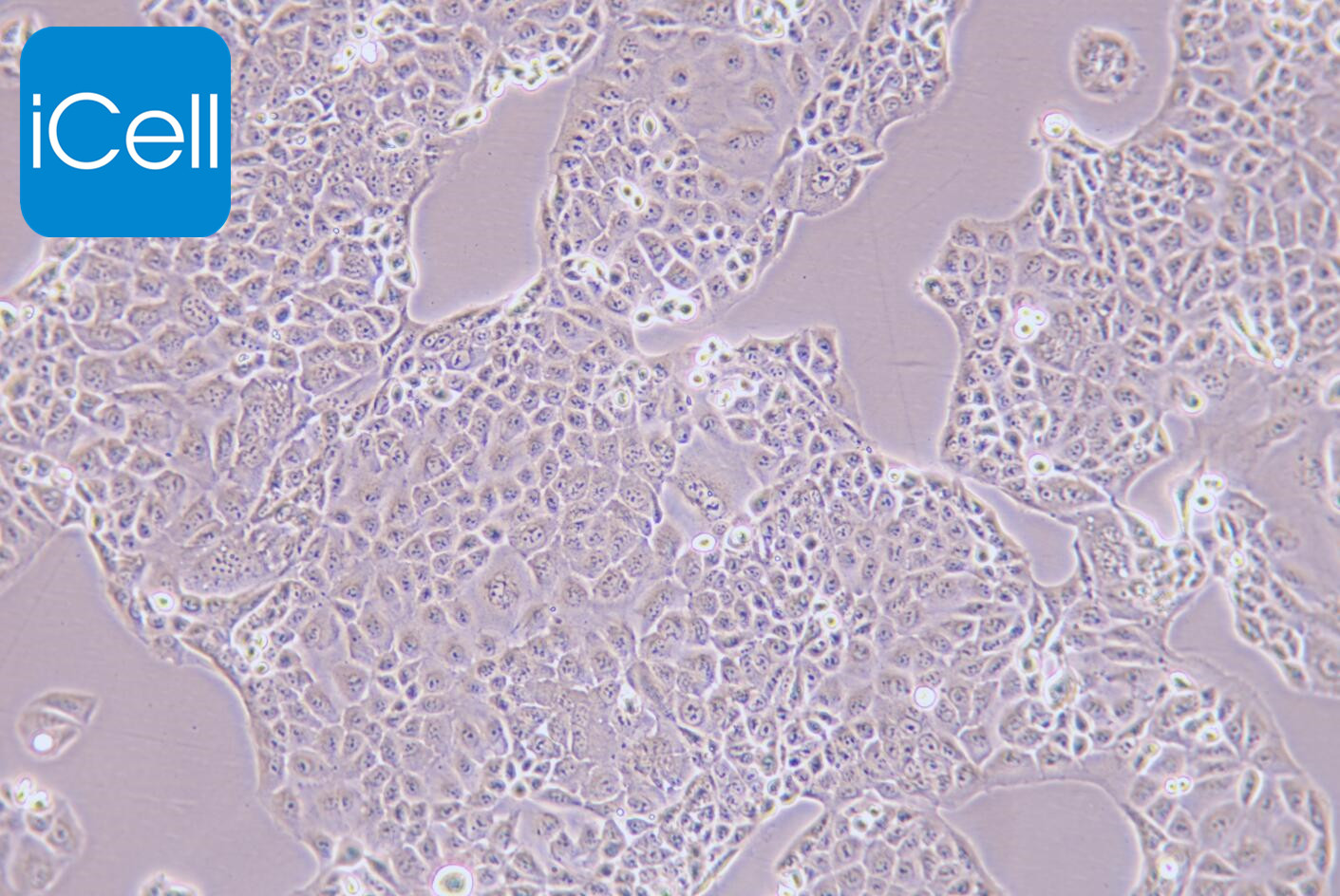 MKN-28 人胃癌细胞-原代细胞-STR细胞-细胞培养基-镜像绮点生物