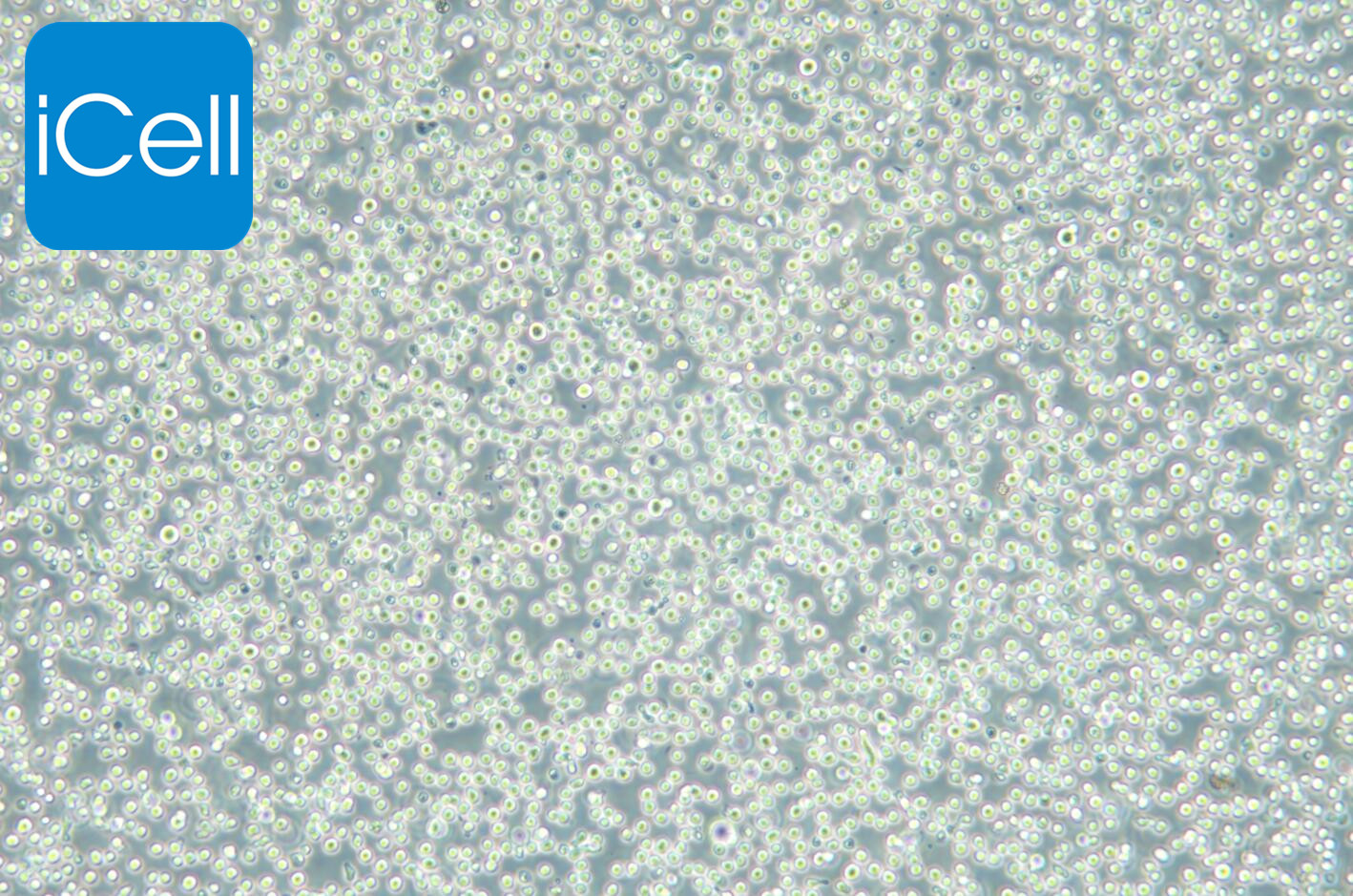 MM.1S 人多发性骨髓瘤细胞-原代细胞-STR细胞-细胞培养基-镜像绮点生物
