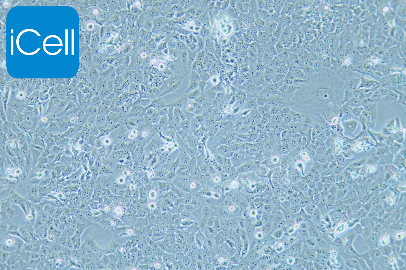 Nthy-ori 3-1 人甲状腺正常细胞-原代细胞-STR细胞-细胞培养基-镜像绮点生物