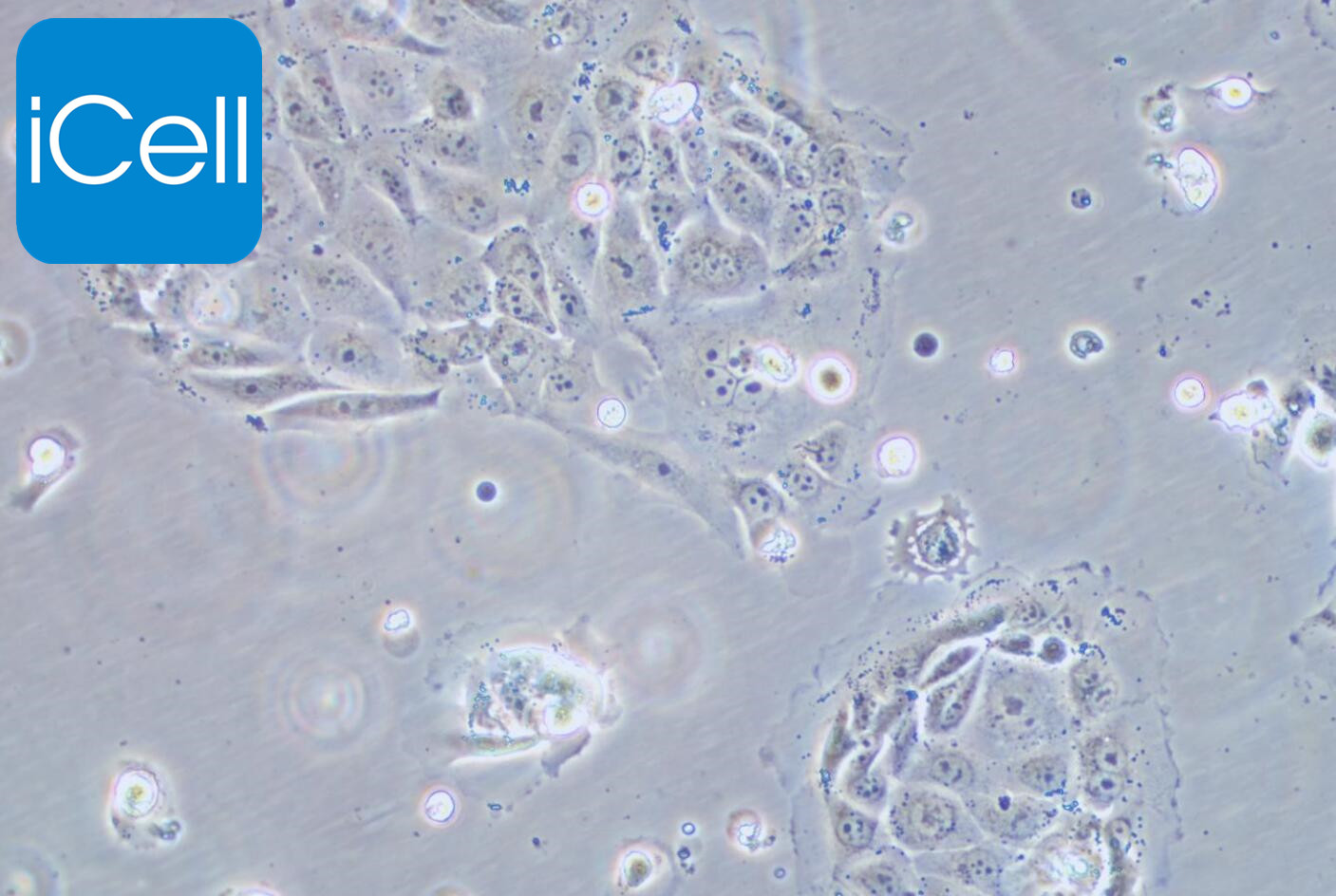 PANC 03.27 人胰腺癌细胞-原代细胞-STR细胞-细胞培养基-镜像绮点生物