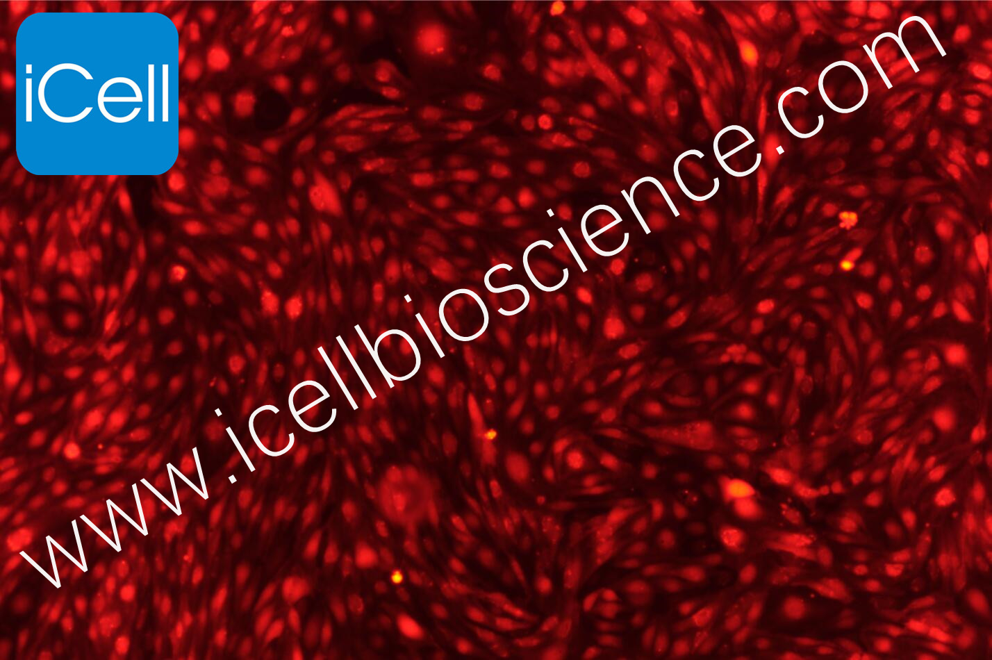 HUVEC+RFP 人脐静脉内皮细胞永生化+RFP-原代细胞-STR细胞-细胞培养基-镜像绮点生物