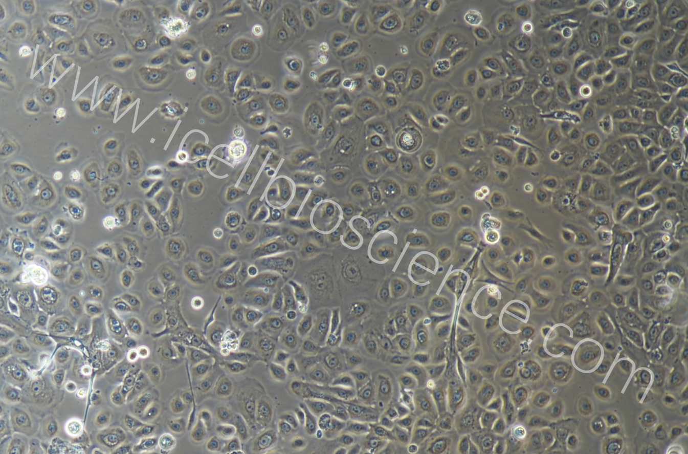 人原代胆脂瘤细胞-原代细胞-STR细胞-细胞培养基-镜像绮点生物