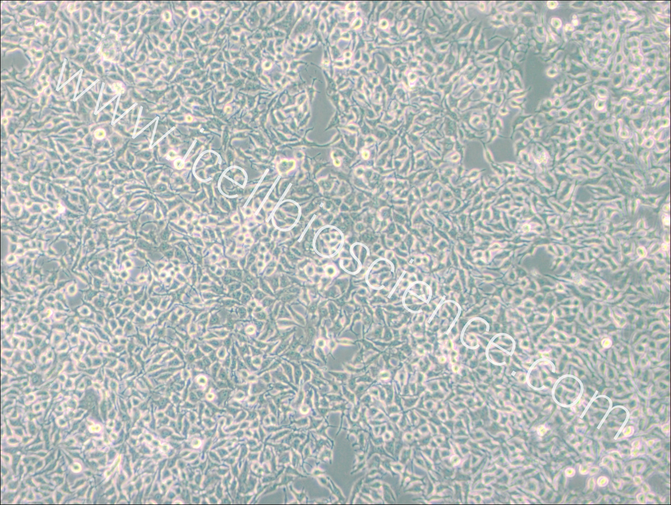 NCI-H3122 人非小细胞肺癌细胞-原代细胞-STR细胞-细胞培养基-镜像绮点生物
