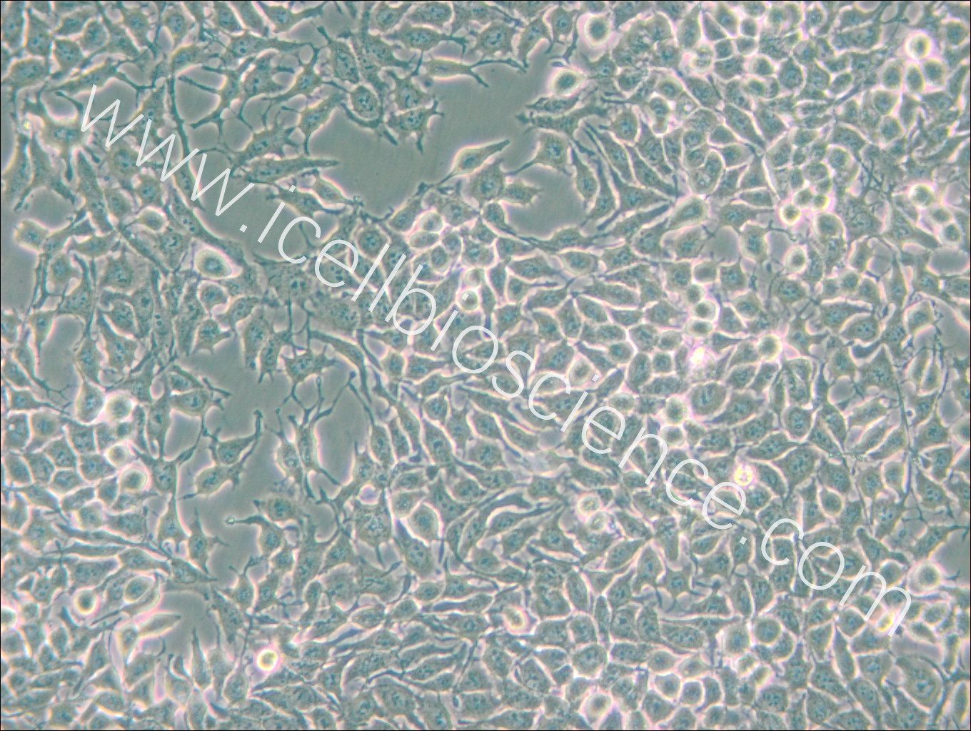 NCI-H3122 人非小细胞肺癌细胞-原代细胞-STR细胞-细胞培养基-镜像绮点生物