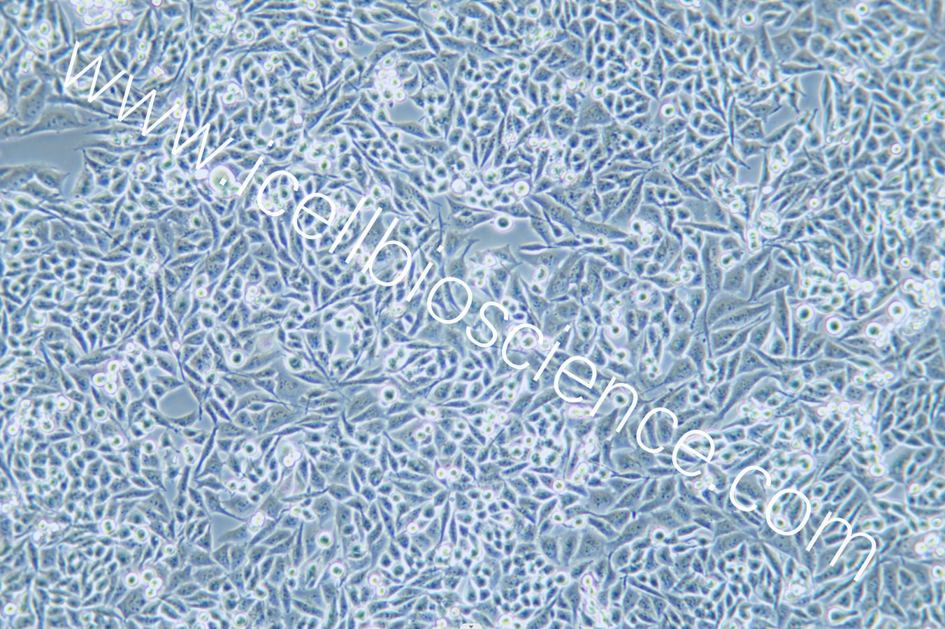 calu-6 人退行性癌细胞-原代细胞-STR细胞-细胞培养基-镜像绮点生物
