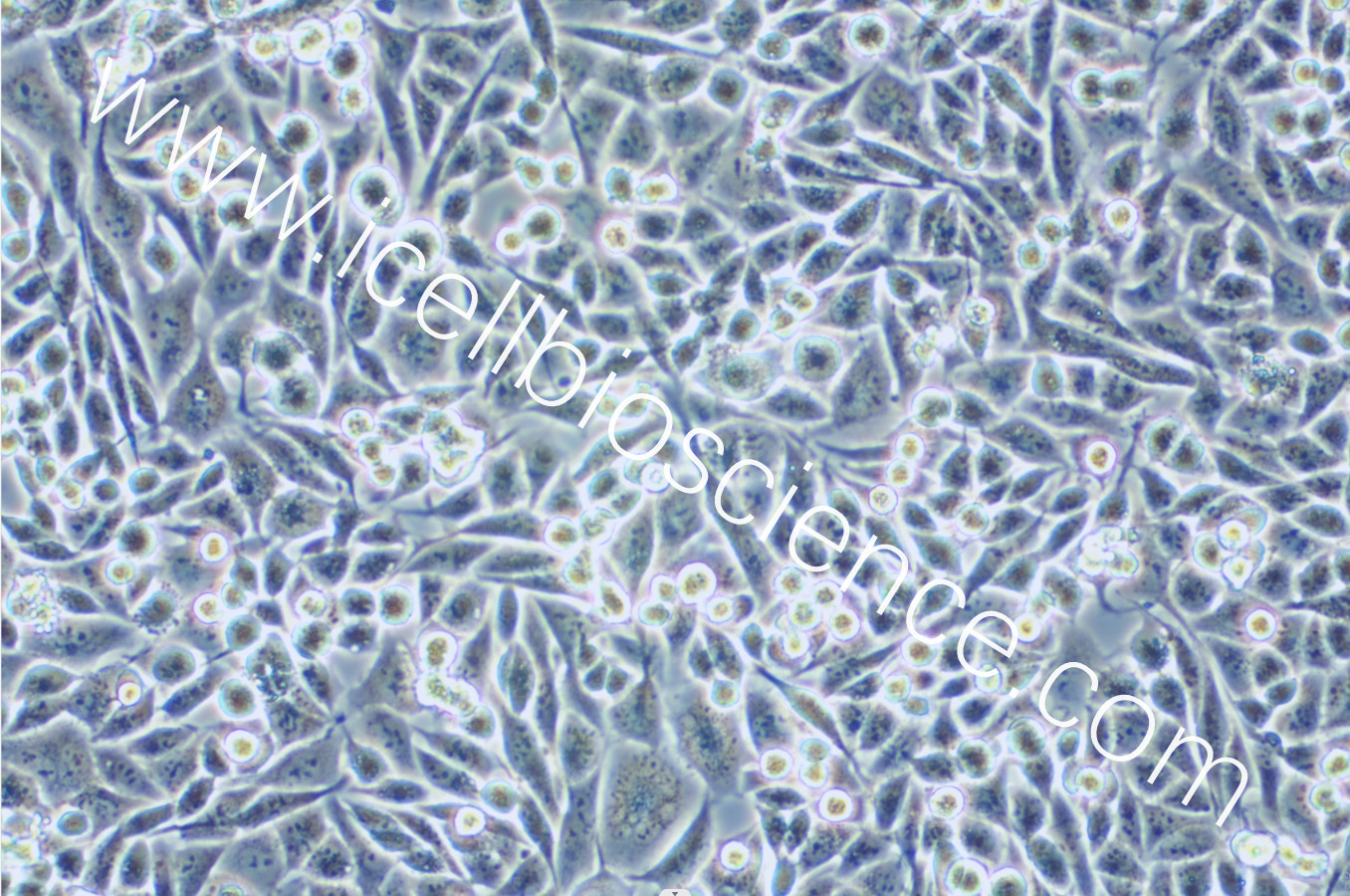 calu-6 人退行性癌细胞-原代细胞-STR细胞-细胞培养基-镜像绮点生物