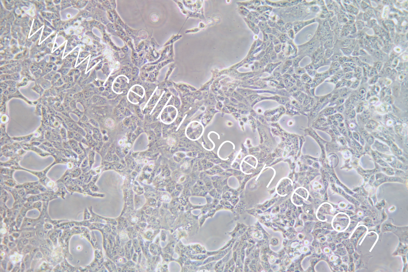 CFPAC-1 人胰腺癌细胞-原代细胞-STR细胞-细胞培养基-镜像绮点生物