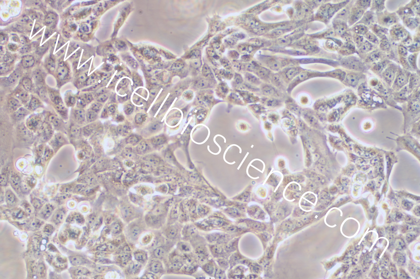 CFPAC-1 人胰腺癌细胞-原代细胞-STR细胞-细胞培养基-镜像绮点生物