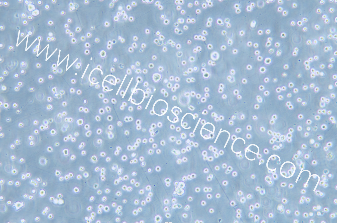 DB 人弥漫性大B细胞淋巴瘤细胞-原代细胞-STR细胞-细胞培养基-镜像绮点生物