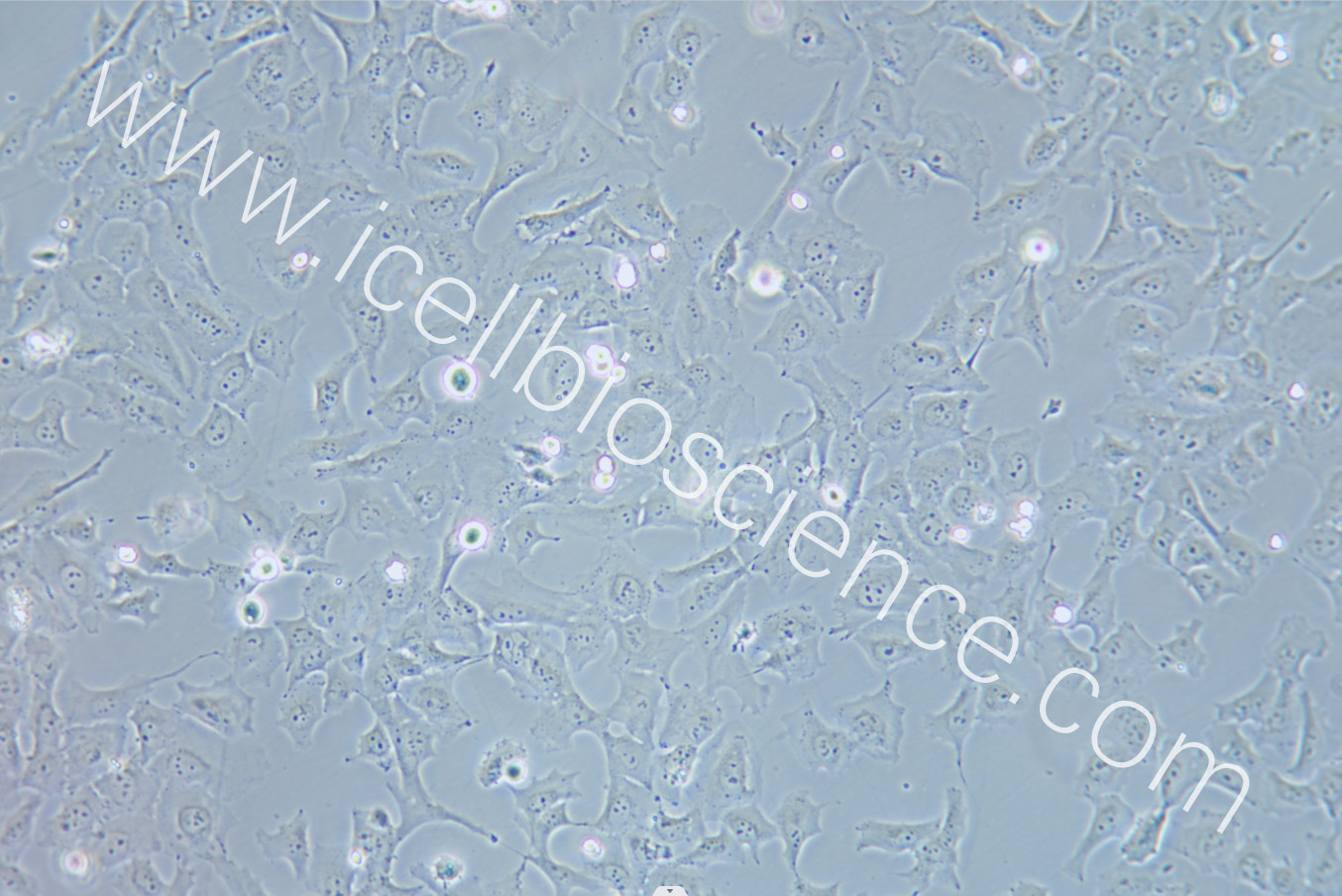 HCC38 乳腺导管癌细胞-原代细胞-STR细胞-细胞培养基-镜像绮点生物