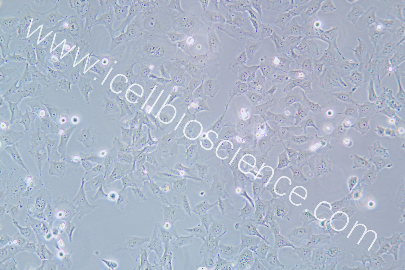 HCC38 乳腺导管癌细胞-原代细胞-STR细胞-细胞培养基-镜像绮点生物