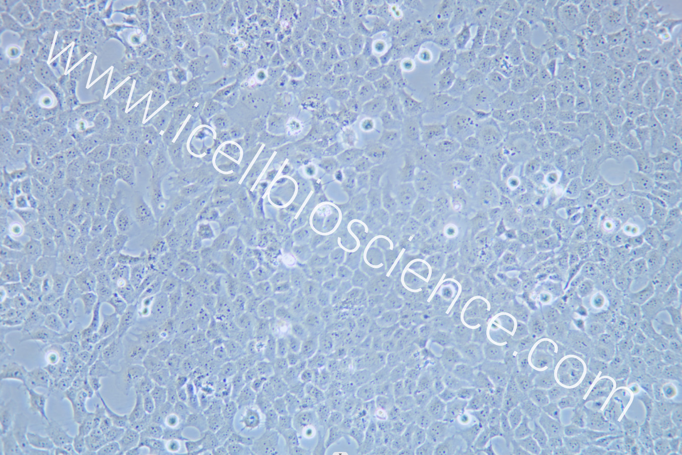 HTR-8/Svneo 人胚胎滋养细胞-原代细胞-STR细胞-细胞培养基-镜像绮点生物