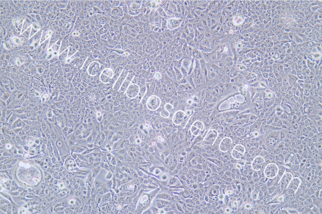 JIMT-1 人乳腺癌细胞-原代细胞-STR细胞-细胞培养基-镜像绮点生物