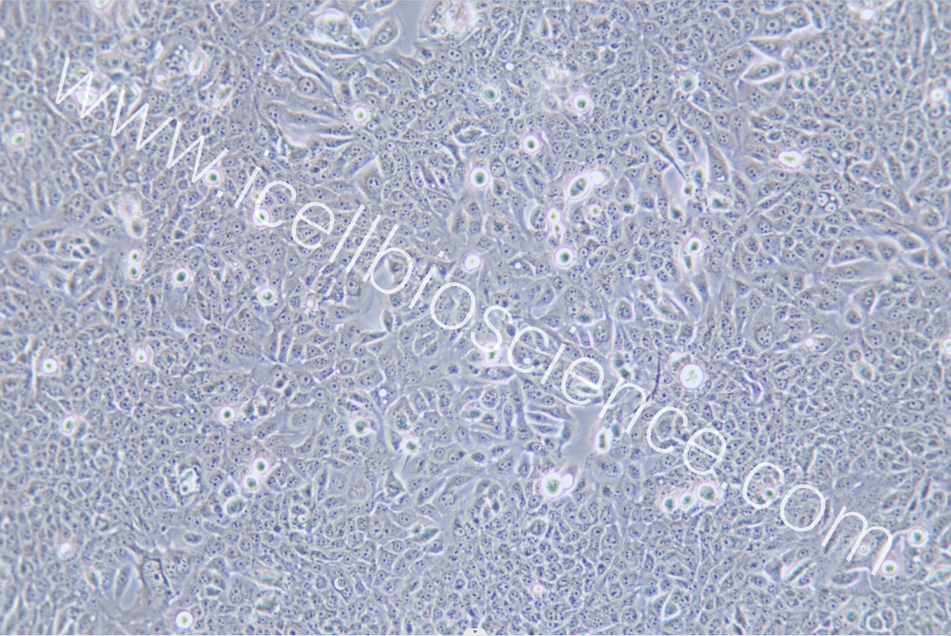 JIMT-1 人乳腺癌细胞-原代细胞-STR细胞-细胞培养基-镜像绮点生物