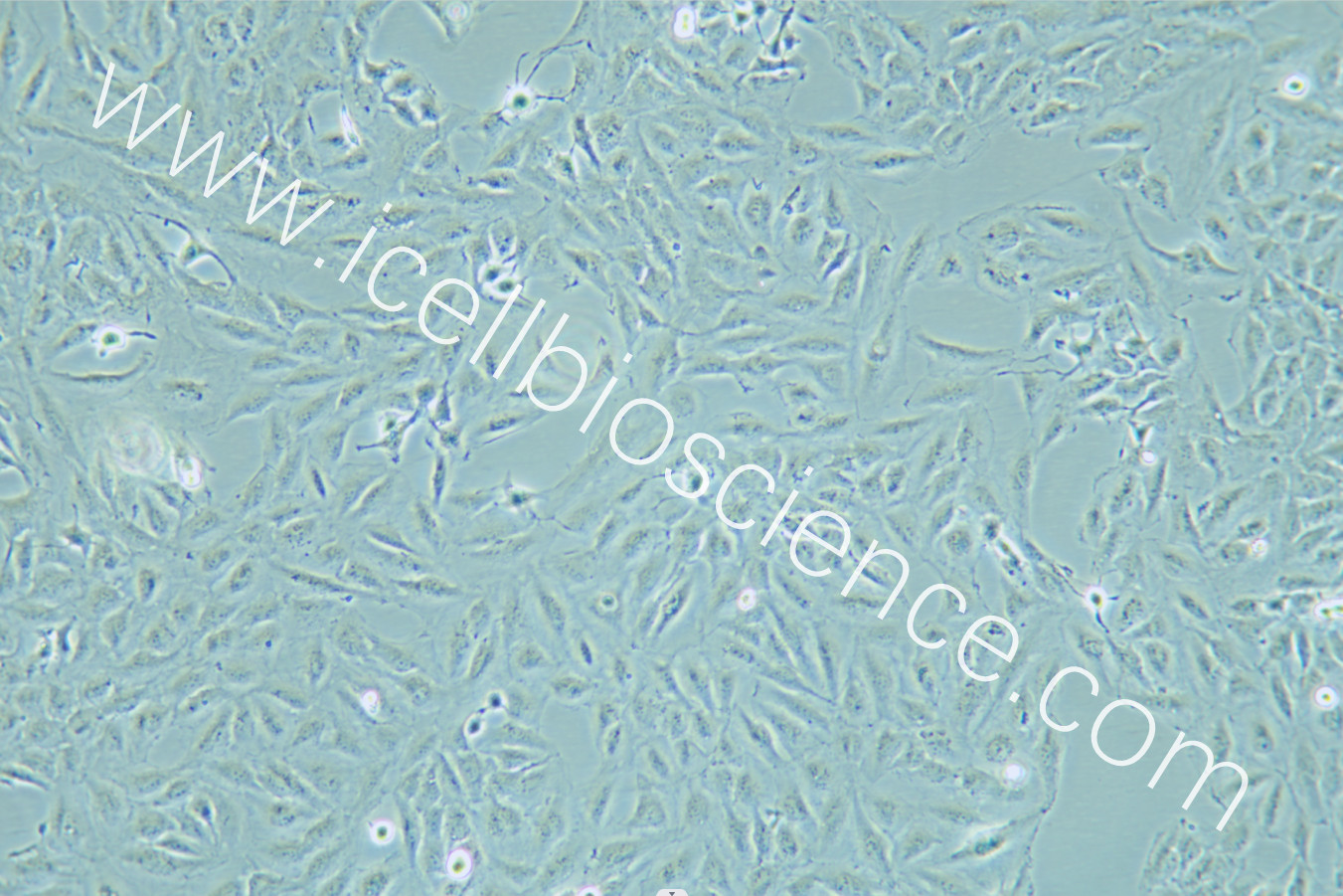 KTC-1 人甲状腺癌细胞-原代细胞-STR细胞-细胞培养基-镜像绮点生物