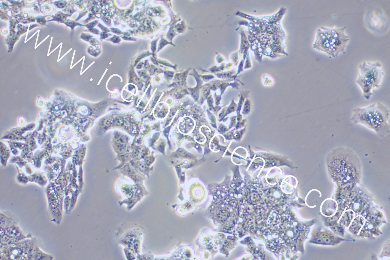 LS1034 人结肠腺癌细胞-原代细胞-STR细胞-细胞培养基-镜像绮点生物