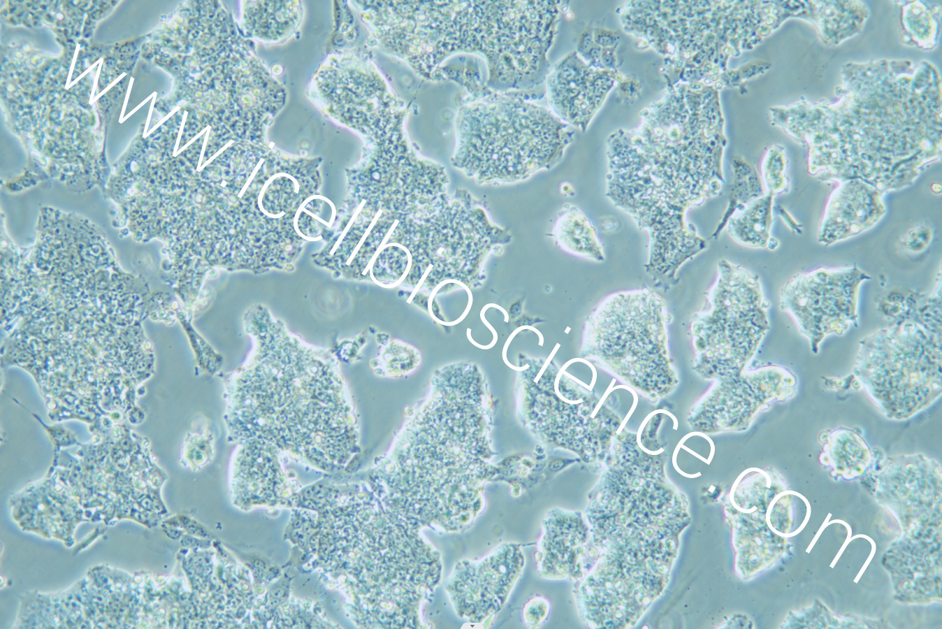 NCI-H508 人结肠直肠腺癌细胞(暂不提供)-原代细胞-STR细胞-细胞培养基-镜像绮点生物