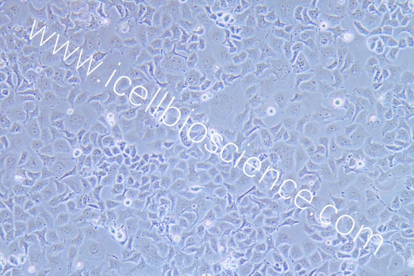 NCI-H522 人非小细胞肺癌腺癌细胞-原代细胞-STR细胞-细胞培养基-镜像绮点生物