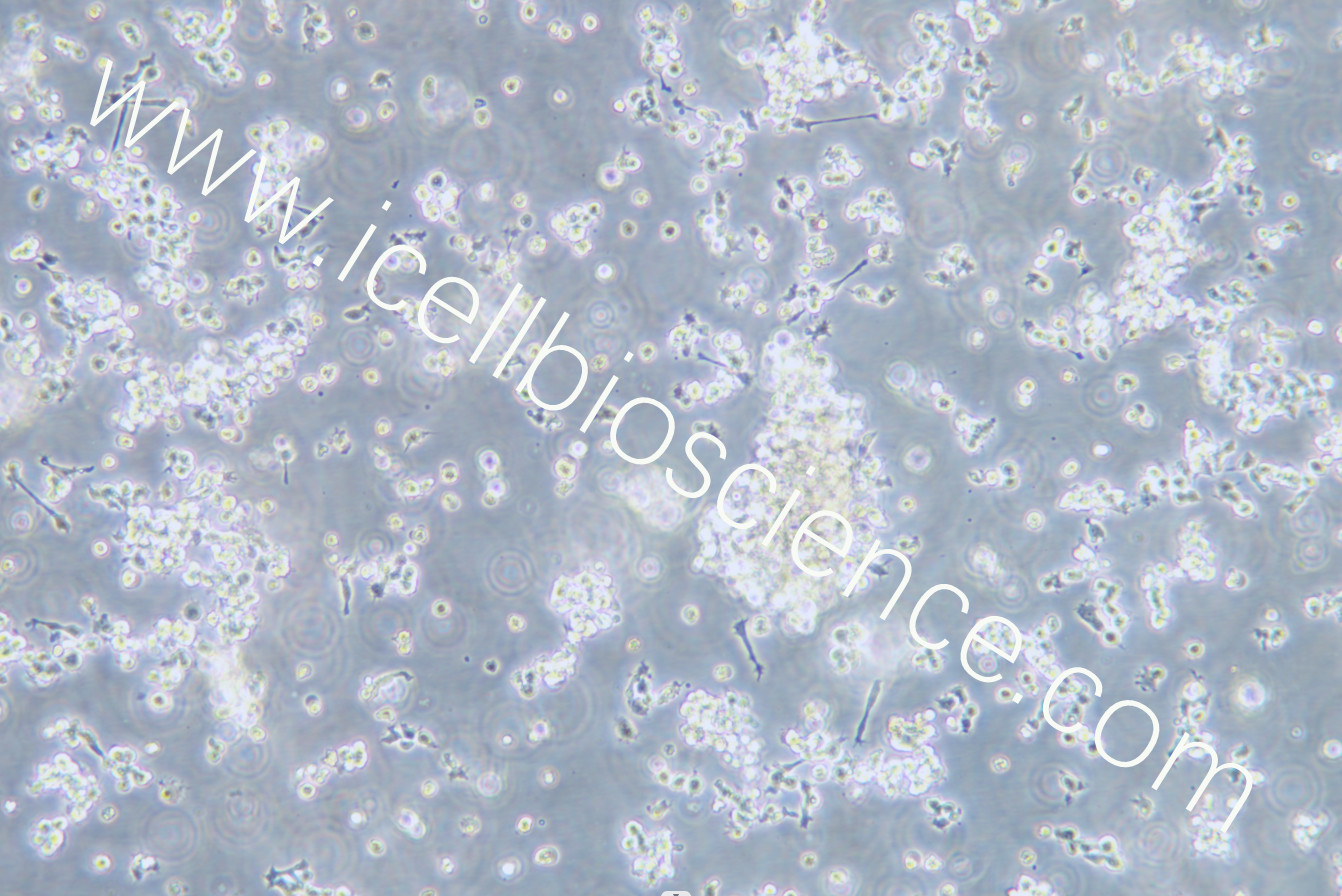 OCI-LY3 人弥漫大B细胞淋巴瘤细胞-原代细胞-STR细胞-细胞培养基-镜像绮点生物