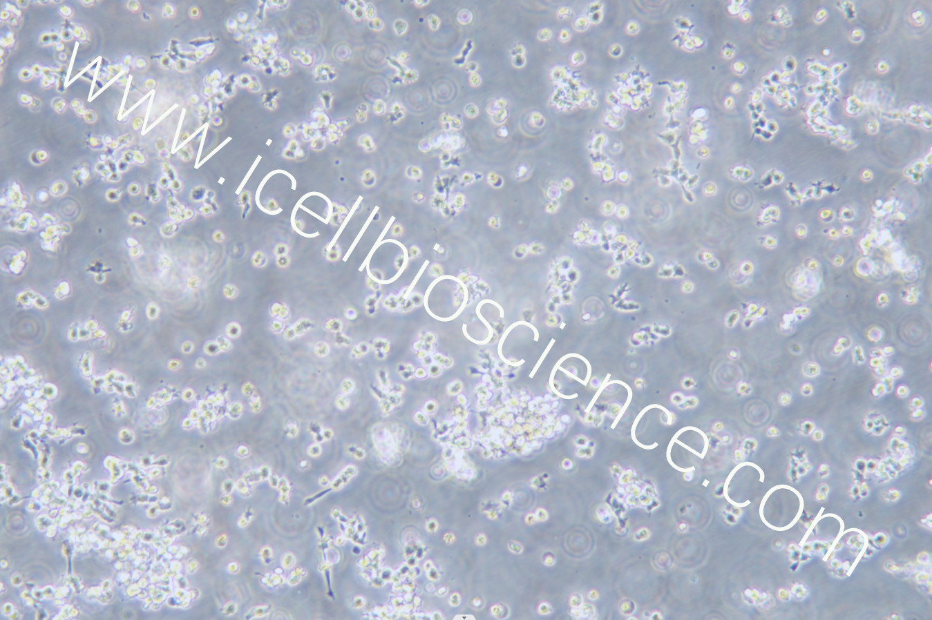 OCI-LY3 人弥漫大B细胞淋巴瘤细胞-原代细胞-STR细胞-细胞培养基-镜像绮点生物