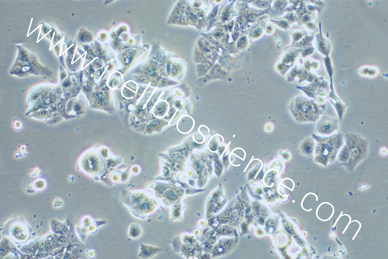 OE19 人食管癌细胞-原代细胞-STR细胞-细胞培养基-镜像绮点生物