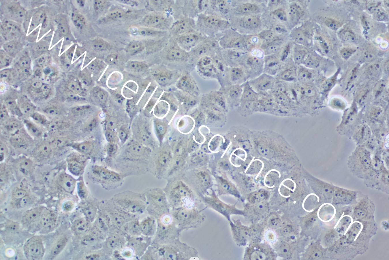 OVCAR-8 人卵巢癌腺癌细胞-原代细胞-STR细胞-细胞培养基-镜像绮点生物