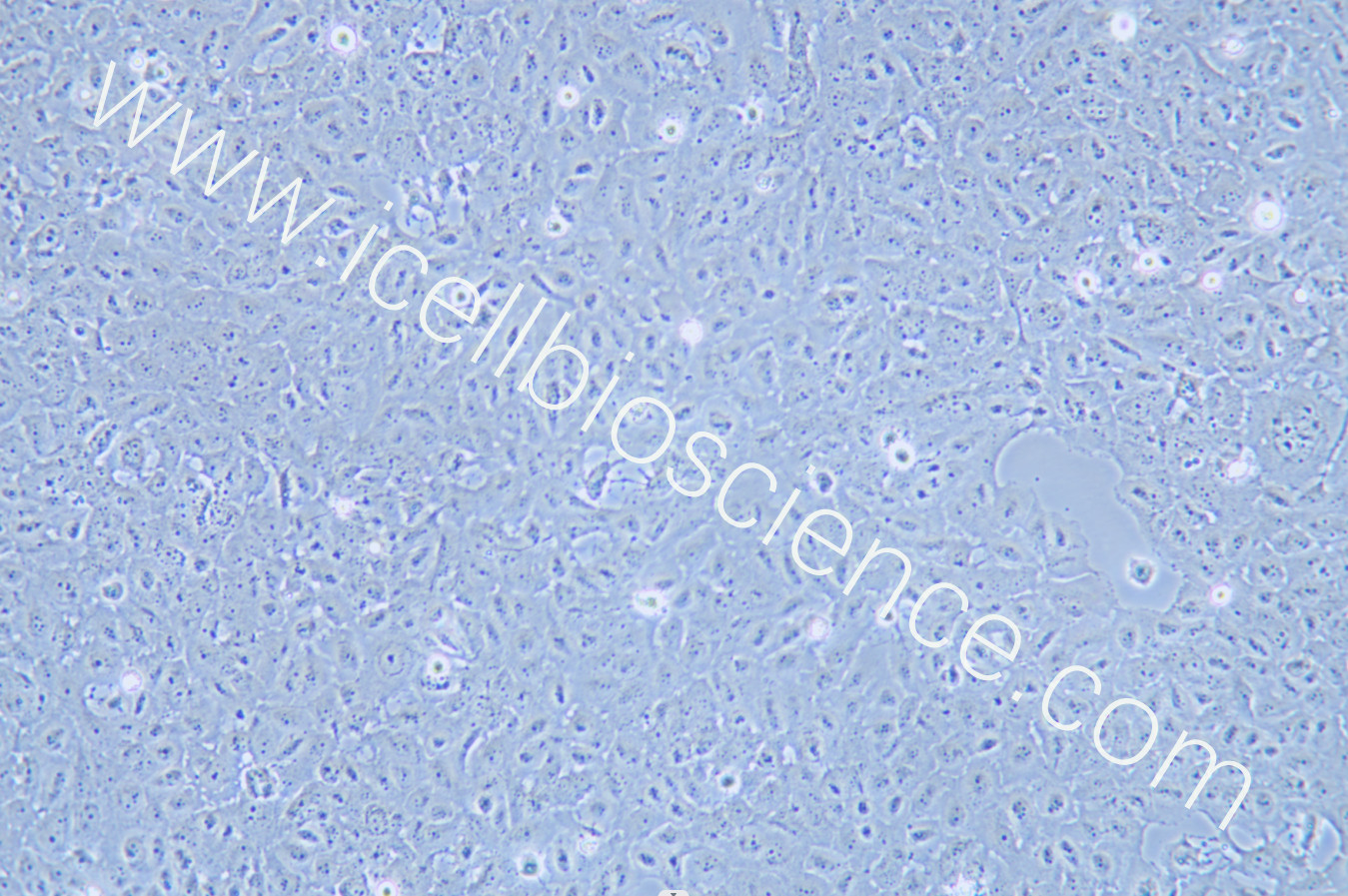 OVCAR-8/ADR 人卵巢癌腺癌阿霉素耐药细胞-原代细胞-STR细胞-细胞培养基-镜像绮点生物