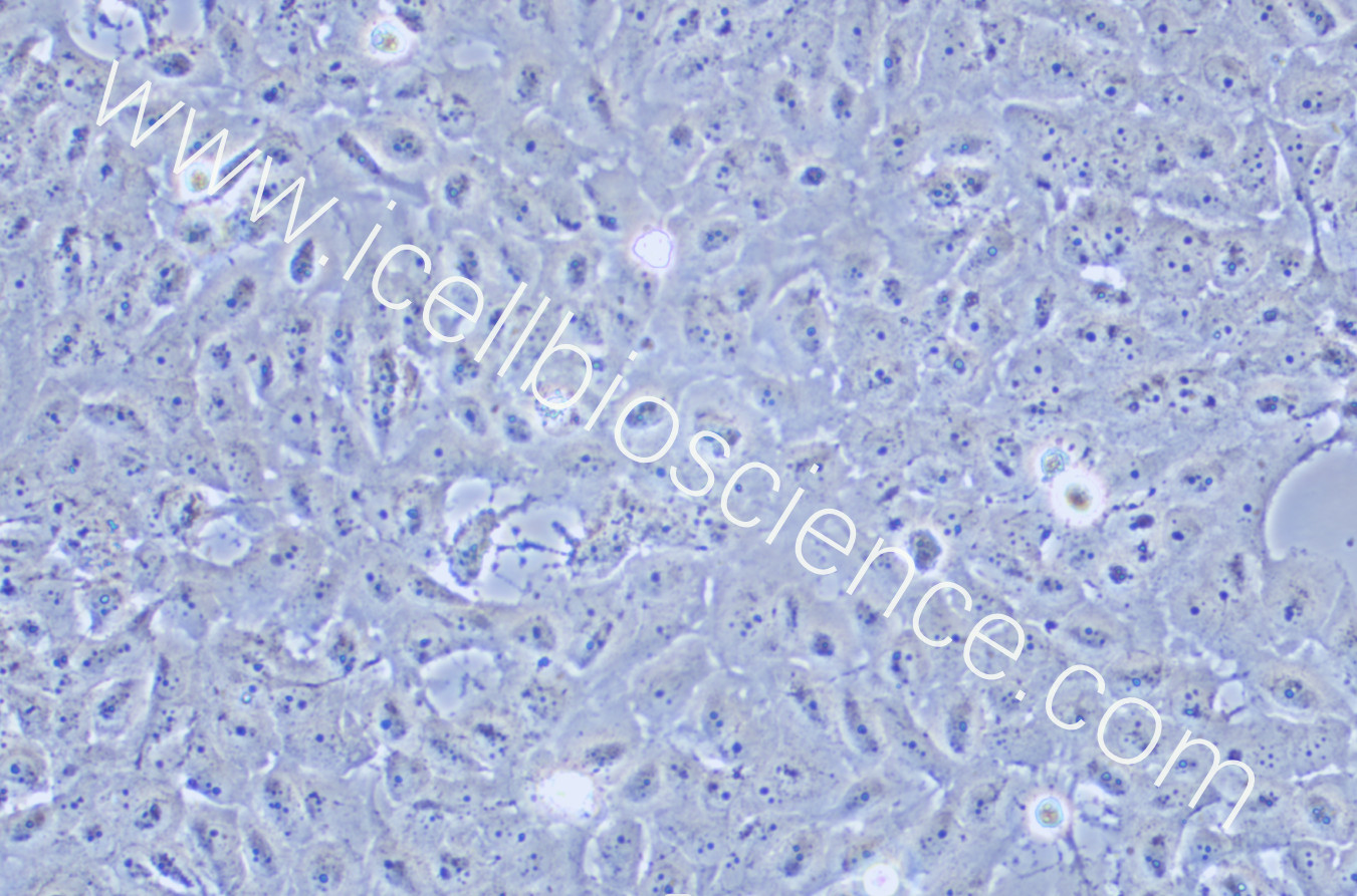 OVCAR-8/ADR 人卵巢癌腺癌阿霉素耐药细胞-原代细胞-STR细胞-细胞培养基-镜像绮点生物