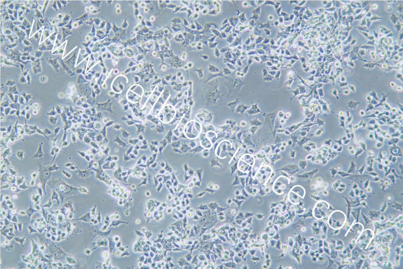 SNU-398 人肝癌细胞-原代细胞-STR细胞-细胞培养基-镜像绮点生物