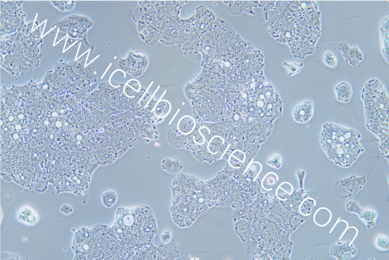 SW948 人结肠腺癌细胞-原代细胞-STR细胞-细胞培养基-镜像绮点生物