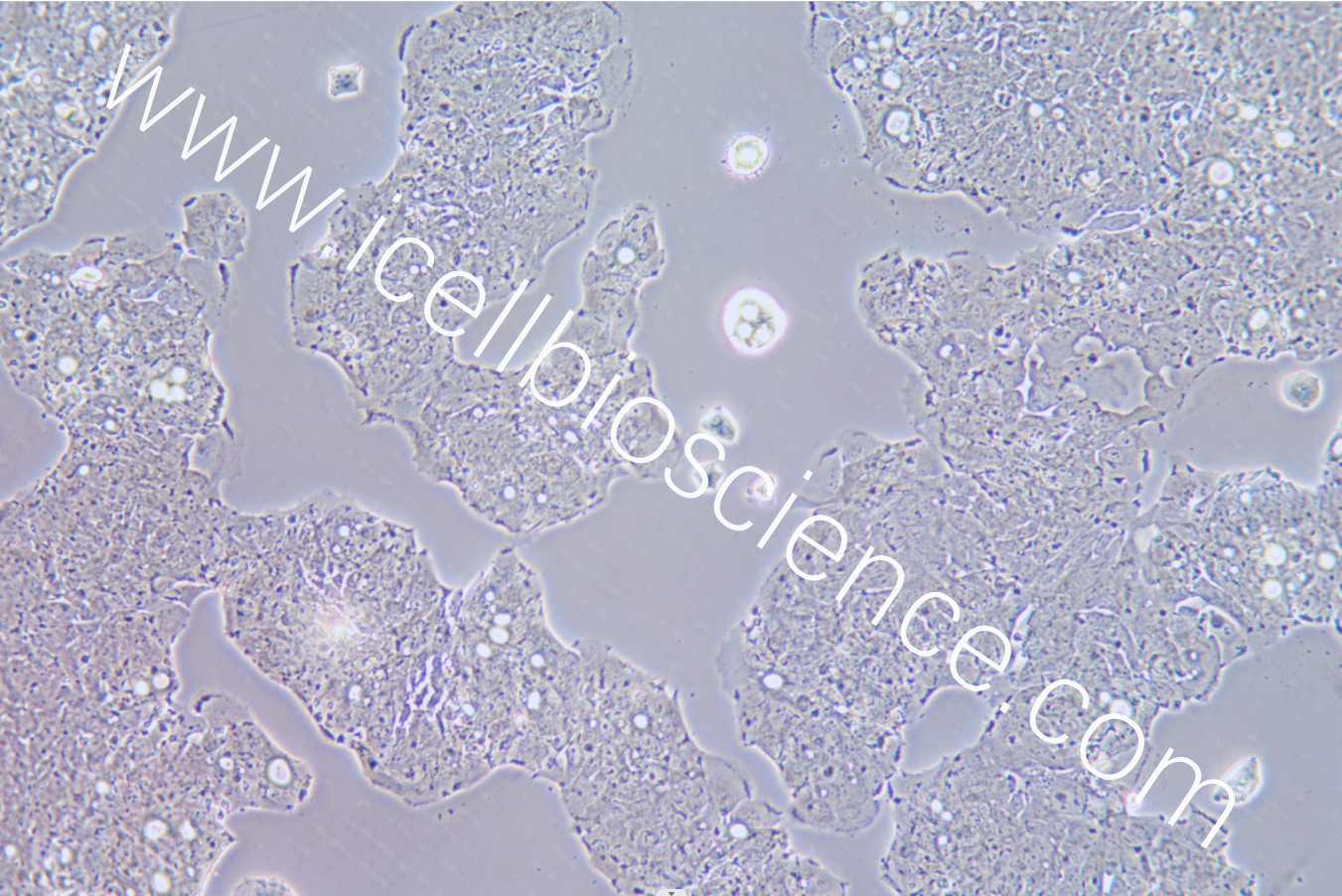 SW948 人结肠腺癌细胞-原代细胞-STR细胞-细胞培养基-镜像绮点生物