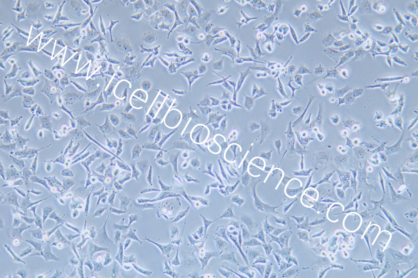 TOV-112D 人上皮性卵巢癌细胞-原代细胞-STR细胞-细胞培养基-镜像绮点生物