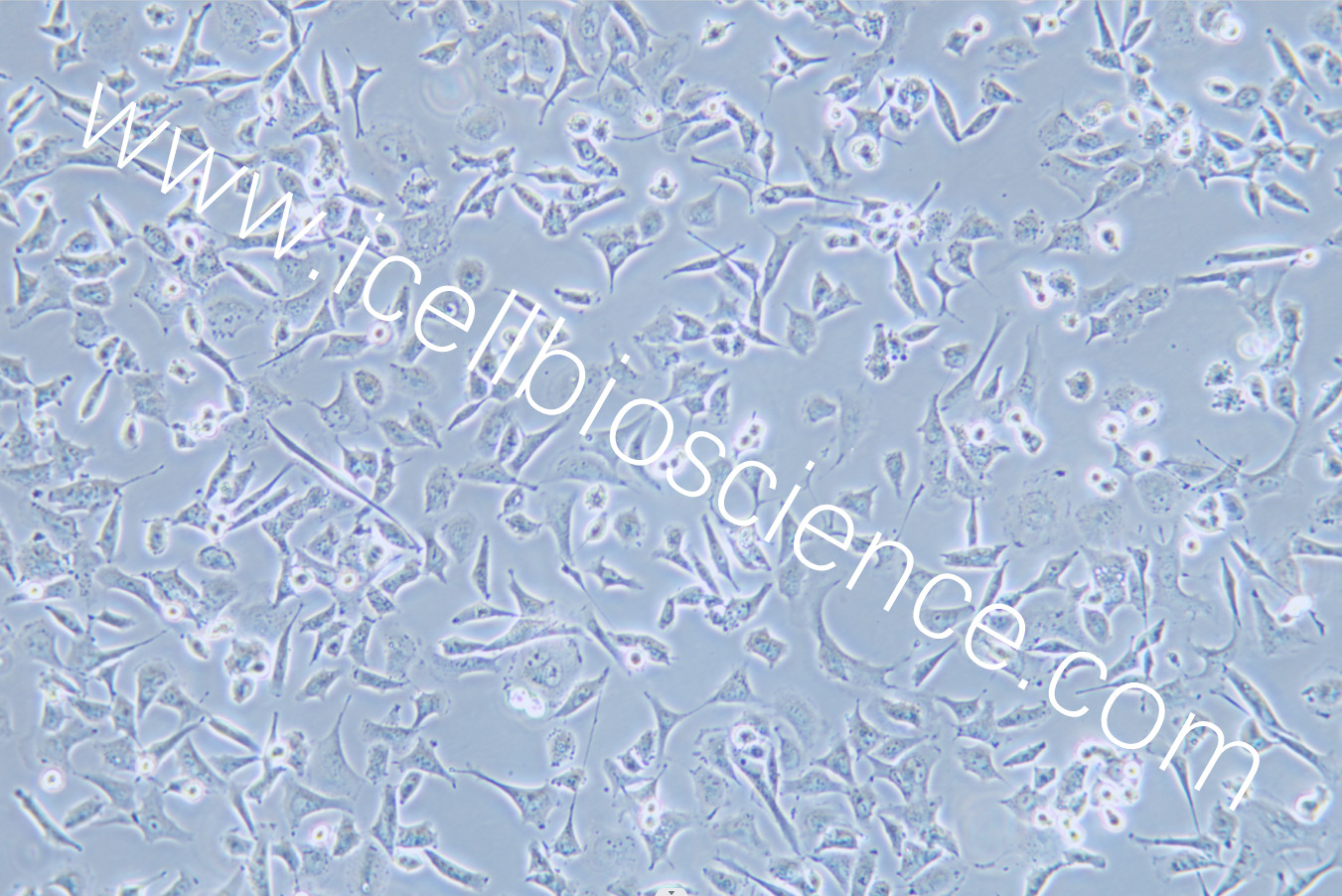 TOV-112D 人上皮性卵巢癌细胞-原代细胞-STR细胞-细胞培养基-镜像绮点生物