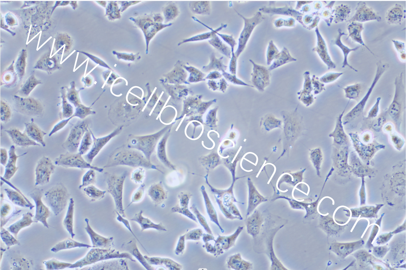 TOV-112D 人上皮性卵巢癌细胞-原代细胞-STR细胞-细胞培养基-镜像绮点生物