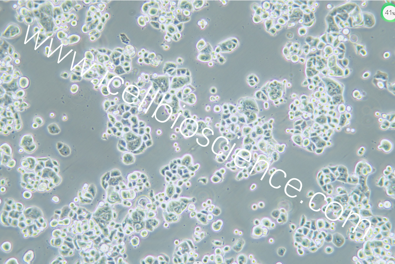 ZR-75-30 人乳腺癌细胞-原代细胞-STR细胞-细胞培养基-镜像绮点生物