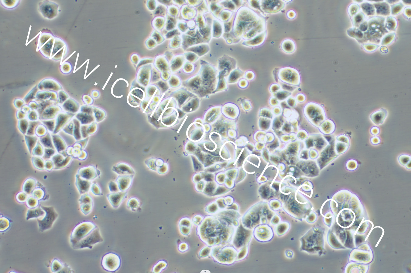 ZR-75-30 人乳腺癌细胞-原代细胞-STR细胞-细胞培养基-镜像绮点生物