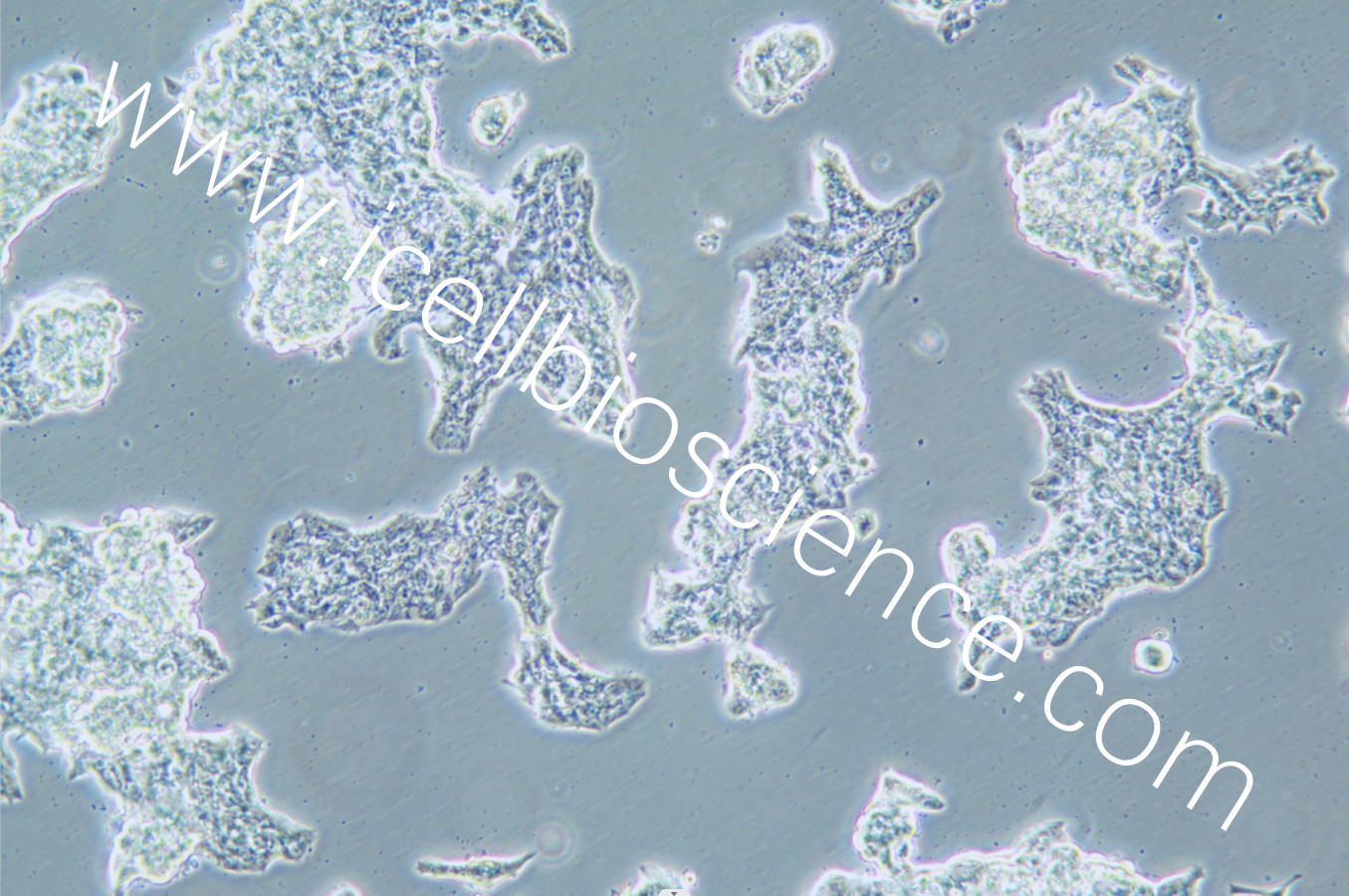 ZR-75-1+luc 人乳腺癌细胞（荧光素酶标记）-原代细胞-STR细胞-细胞培养基-镜像绮点生物