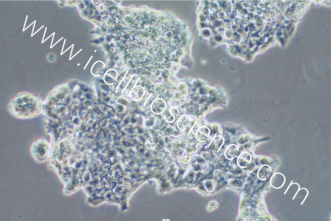 ZR-75-1+luc 人乳腺癌细胞（荧光素酶标记）-原代细胞-STR细胞-细胞培养基-镜像绮点生物